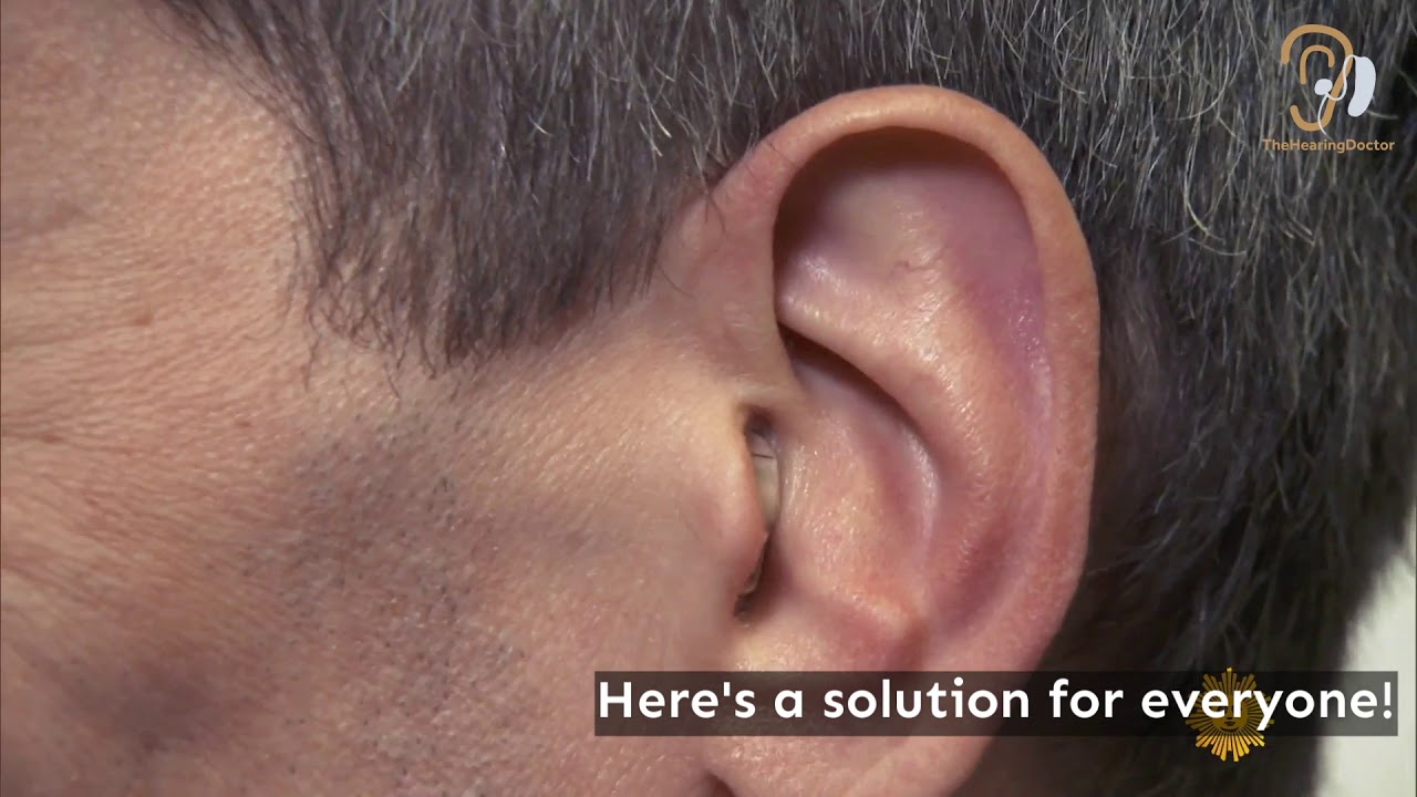 The Smallest Behind The Ear Hearing Aid - YouTube