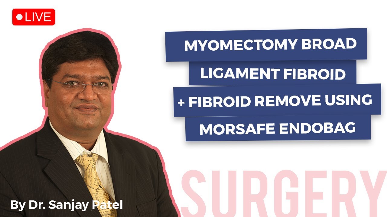 Myomectomy Broad Ligament Fibroid + Fibroid Remove Using Morsafe ...
