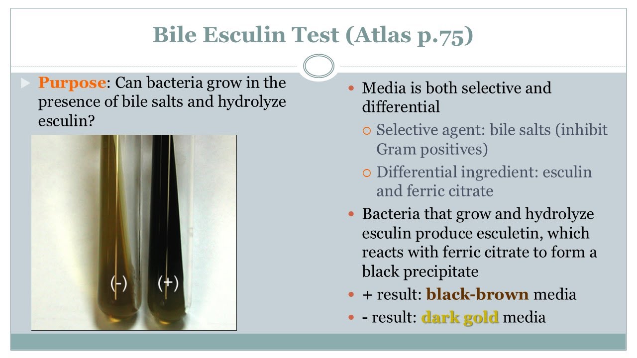 Title_ Bile Esculin Test - Microbiology Class - Podcast (CC) - YouTube