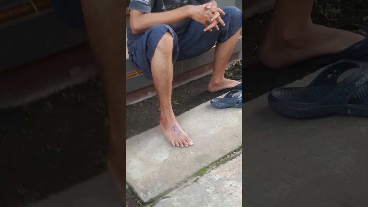 kay pengobatan segala penyakit - YouTube