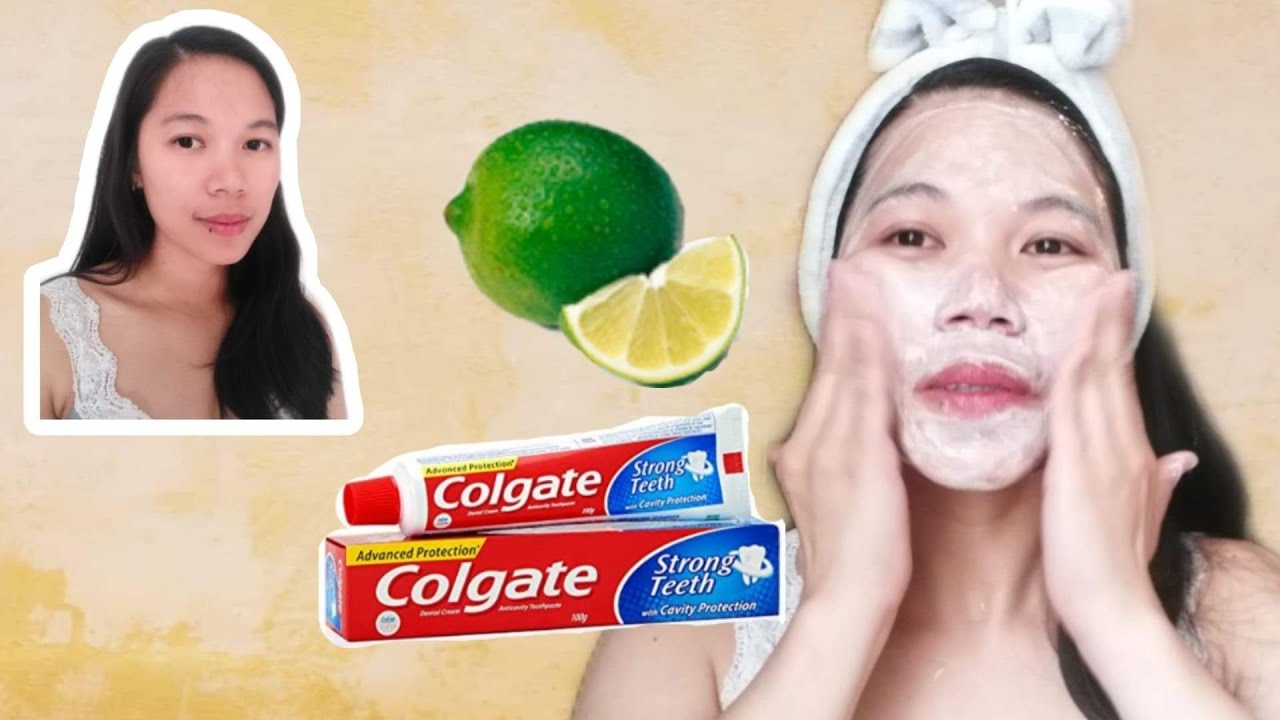 COLGATE & LEMON FACE MASK | LIGHTEN DARK SPOT,ACNE SCARS ON FACE - YouTube