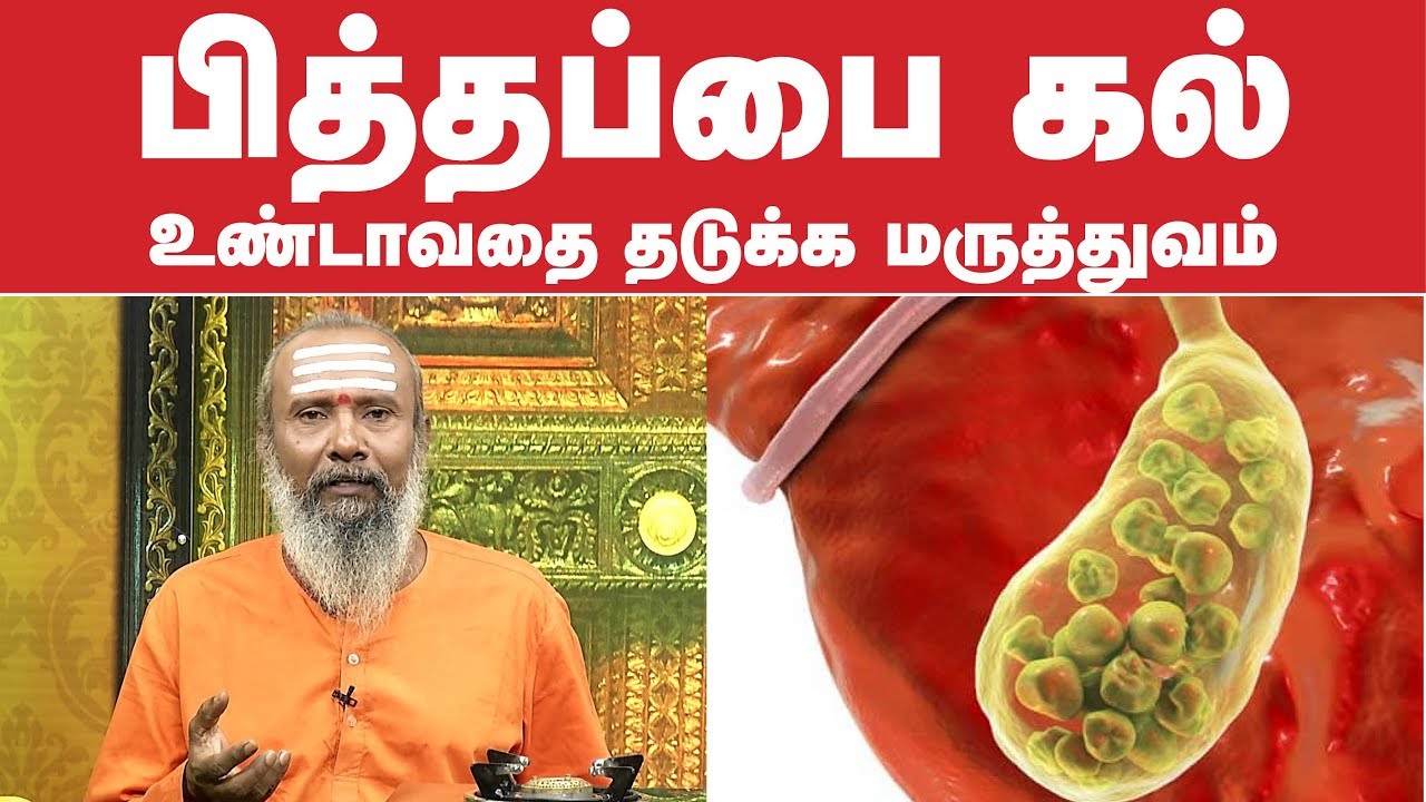 பித்தப்பை கல் உண்டாவதை தடுக்க மருத்துவம் | Gallbladder Stone ...