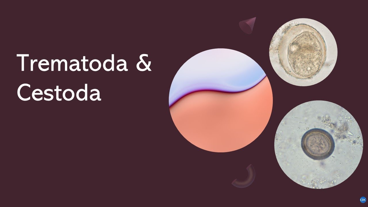 Overview Kuliah Cacing Trematoda dan Cestoda - YouTube