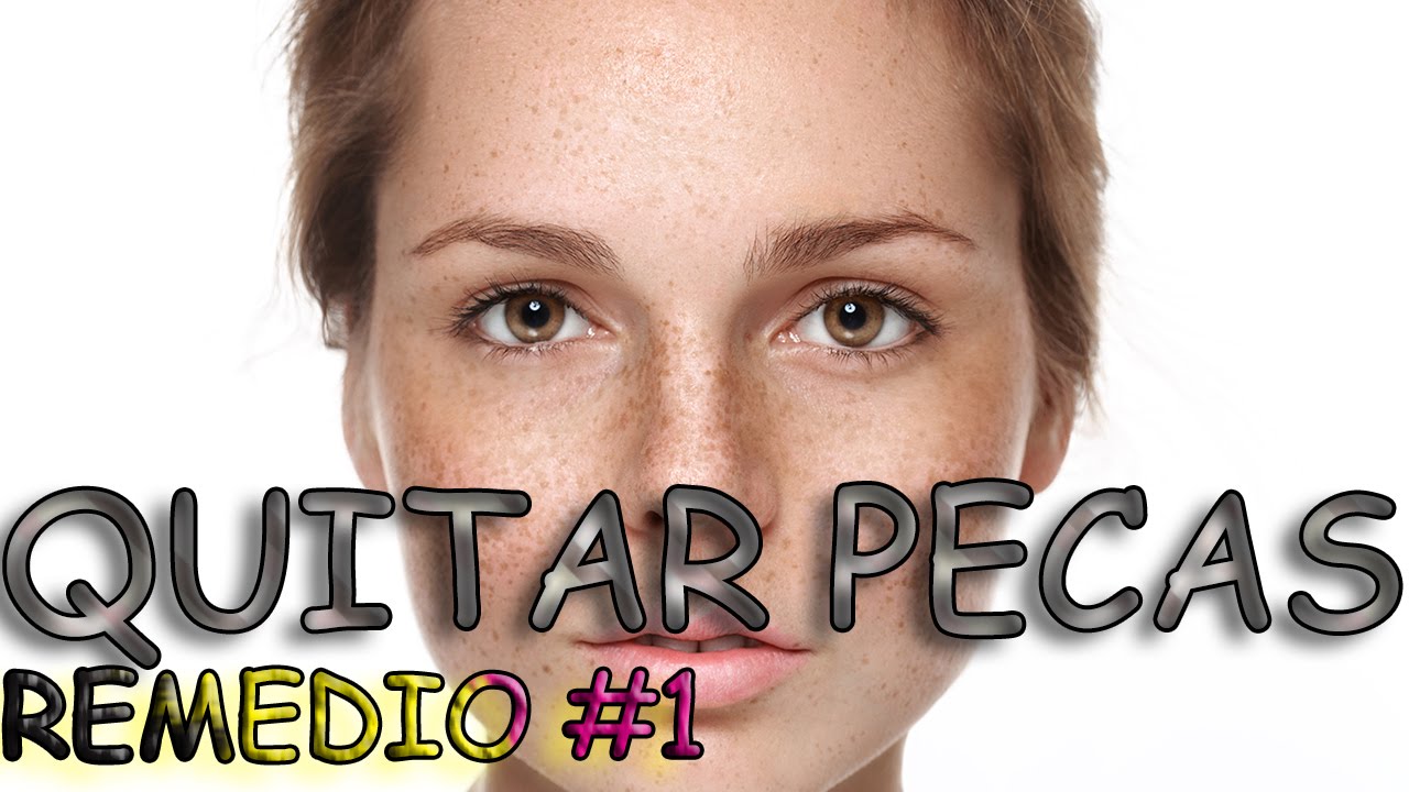 Pecas | Remedios Caseros Para Quitar Las Pecas | Como Quitar Las Pecas ...