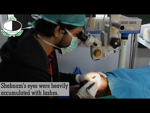 Shabnam | Electro-Epilation | Al-Shifa Trust Eye Hospital - YouTube