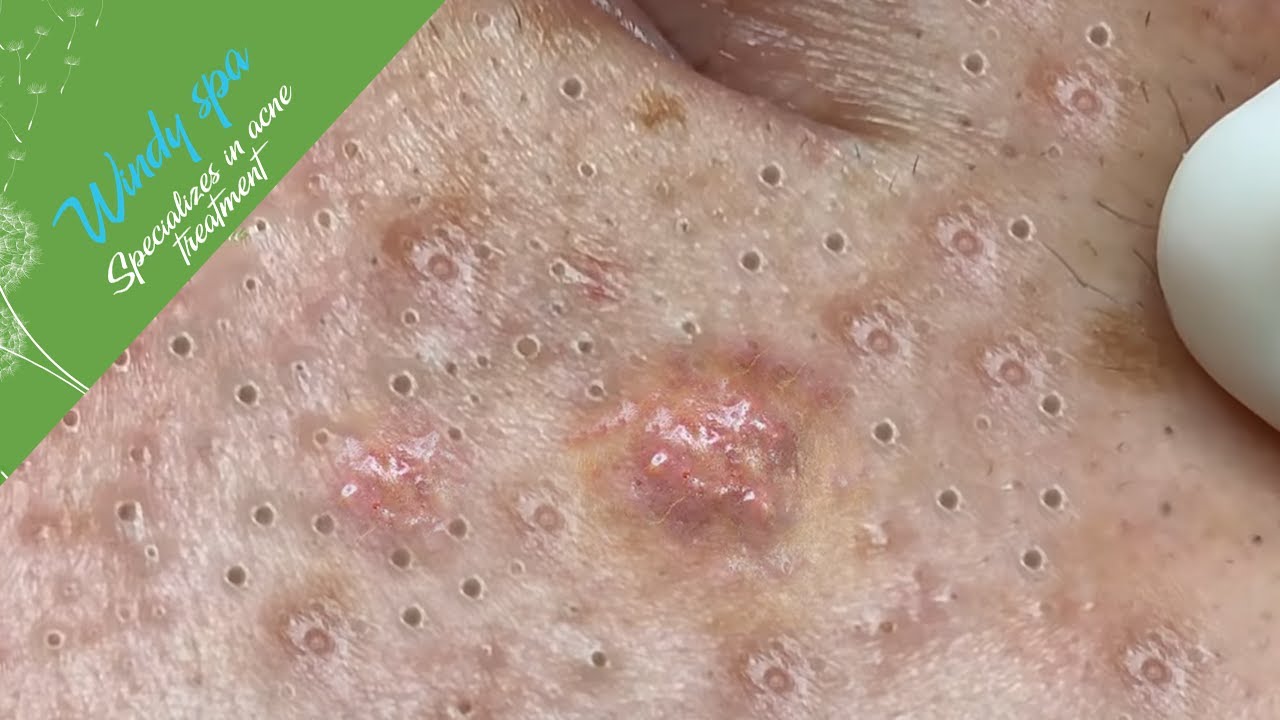 Make Your Day Relaxing with Windy Spa 6#180 - YouTube