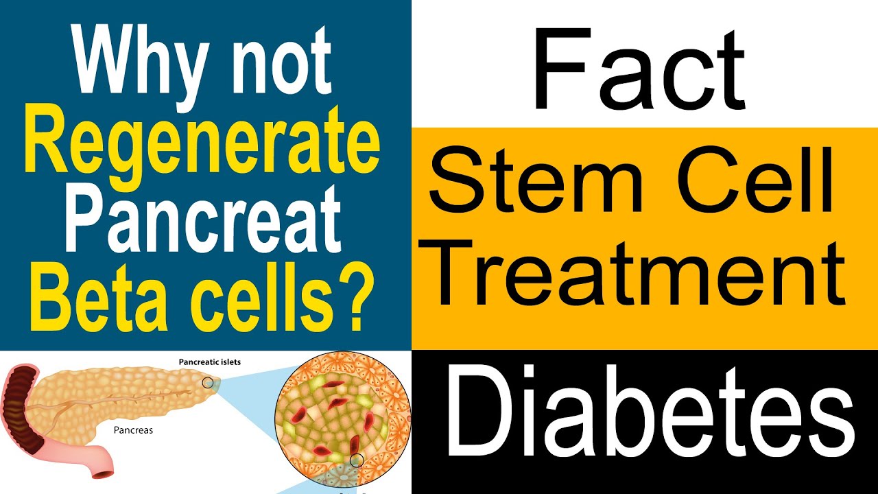 Stem Cell Fact On DIABETES || Why not Regenerate Pancreat Beta Cells ...