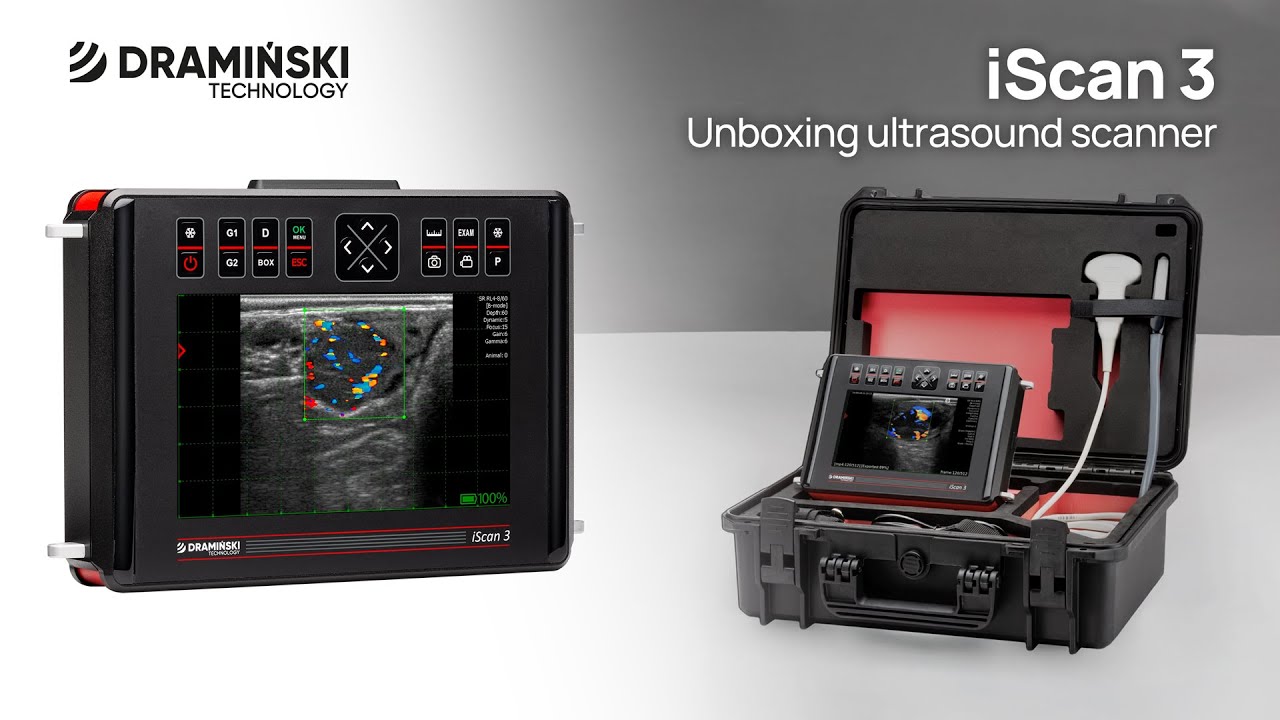 iScan 3 UNBOXING of NEW ultrasound scanner with colour Doppler imaging ...