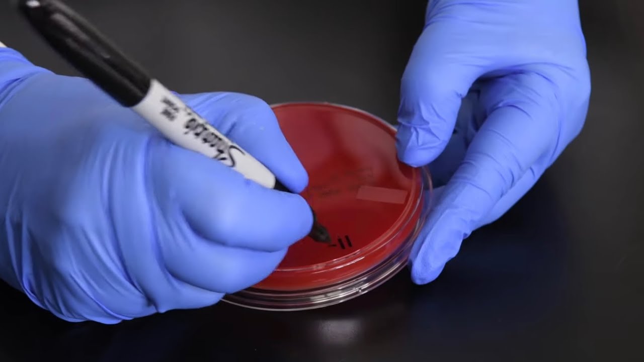 General Microbiology/ ospe practical (viva)3rd year pathology ospe ...