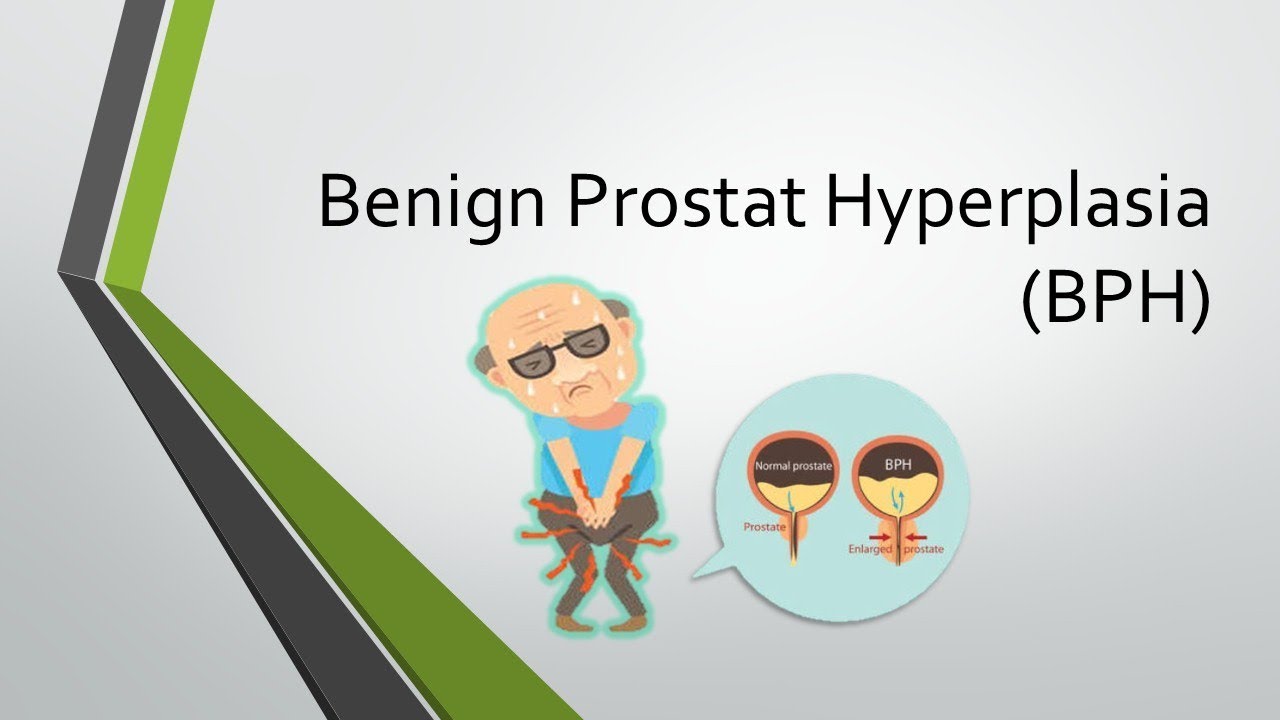 Pembesaran Prostat Pada Pria Benign Prostatic Hyperplasia Bph Youtube