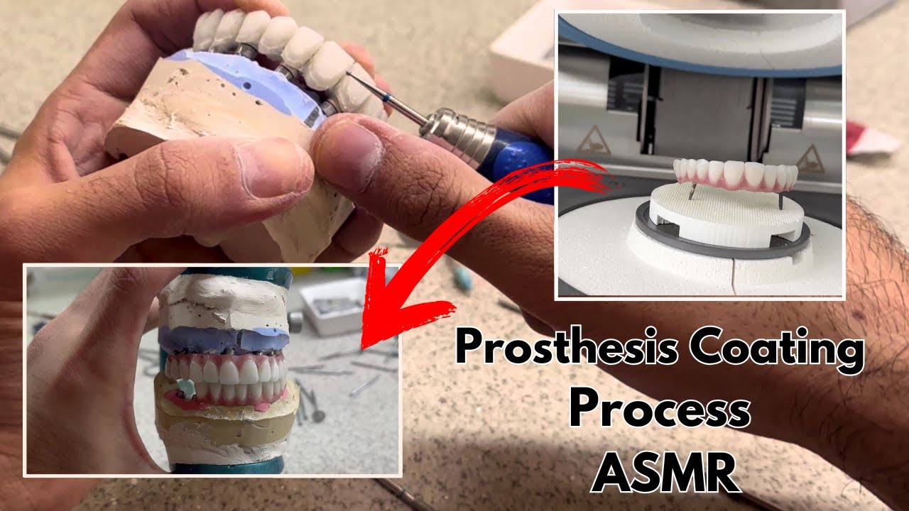 Prosthesis Coating Process | Prosthesis levelling | Part 3 | ASMR - YouTube