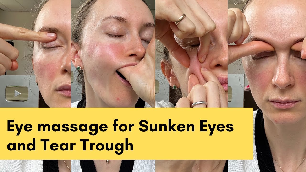 Eye Massage For Sunken Eyes And Tear Trough YouTube Eye Massage For Sunken Eyes And Tear Trough YouTube