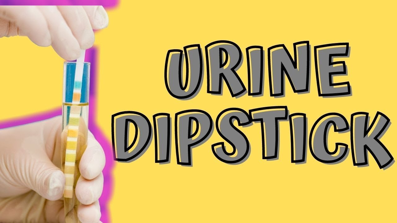 Home Tests For UTI Using Urine Dipstick With Dr Robert Chan At Home home-tests-for-uti-using-urine-dipstick-with-dr-robert-chan-at-home