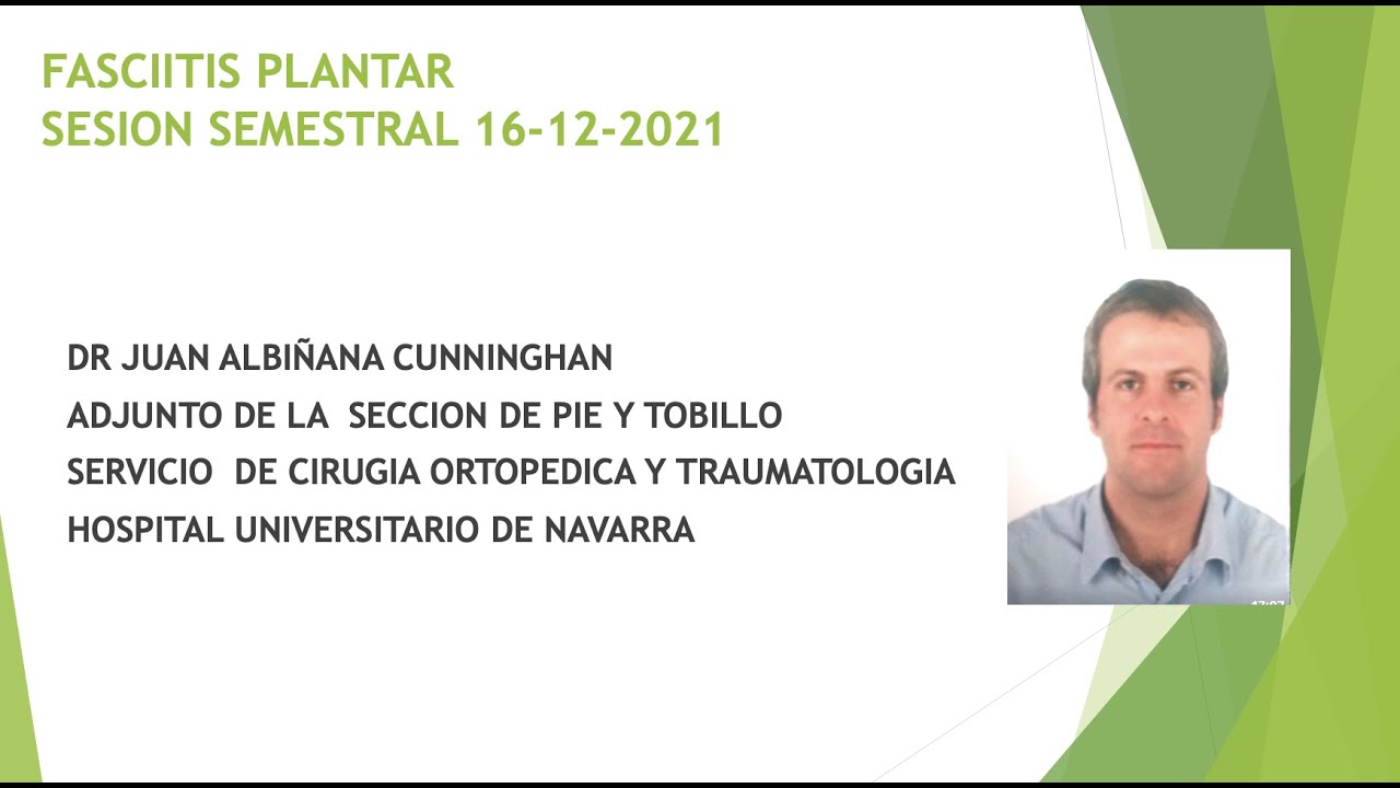 FASCIITIS PLANTAR TRATAMIENTO MEDIANTE SECCION DE GEMELO INTERNO - YouTube