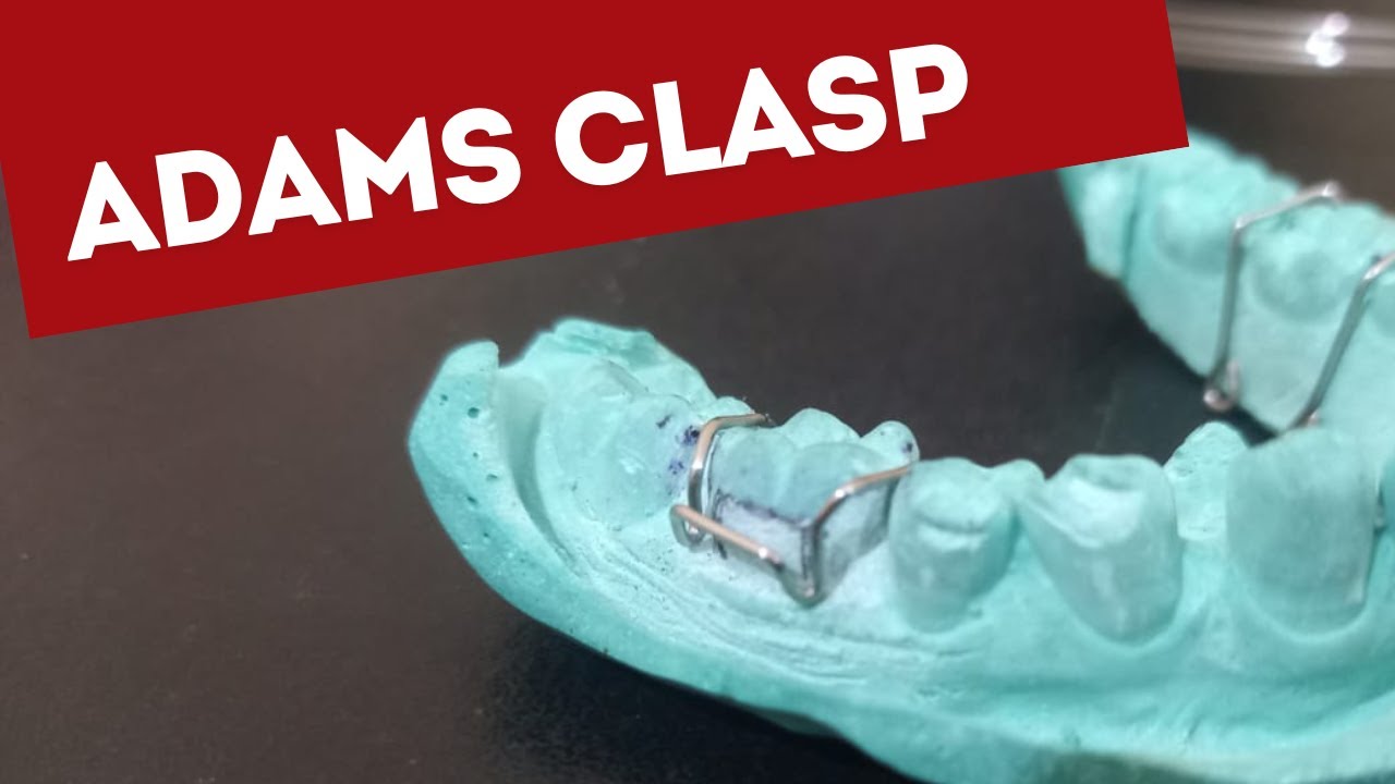 Adams clasp demonstration step by step fabrication | orthodontics ...