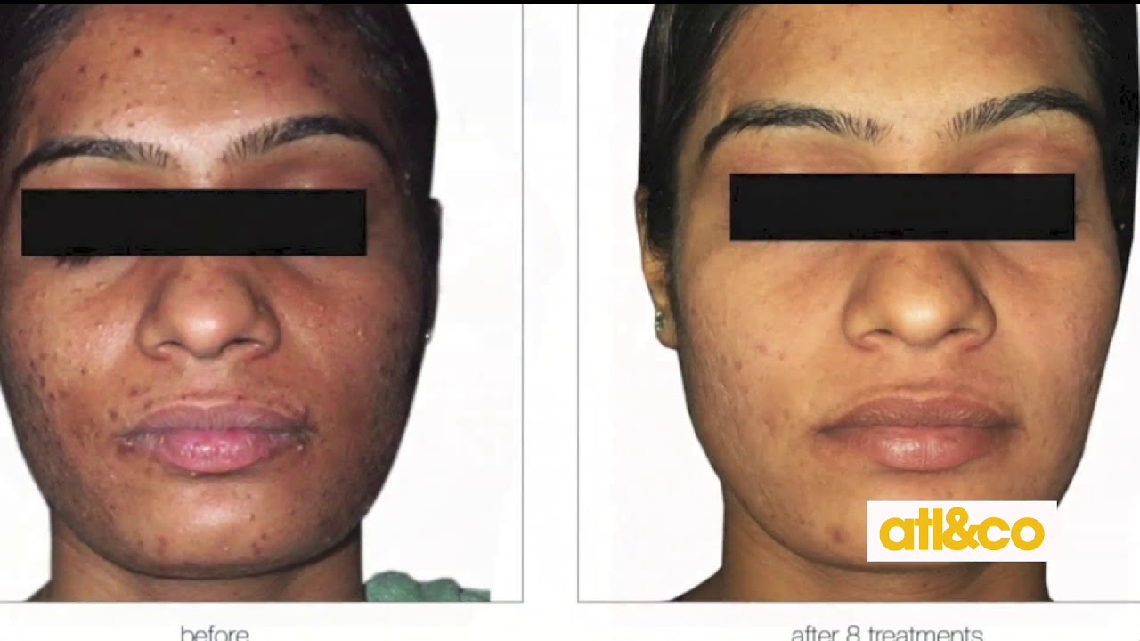 Angel on Atlanta and Company for Plastic Surgery Centre of Atlanta ...