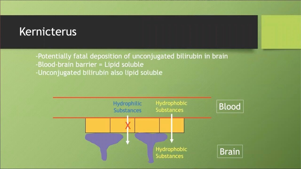 Hereditary Hyperbilirubinemia Syndromes - YouTube