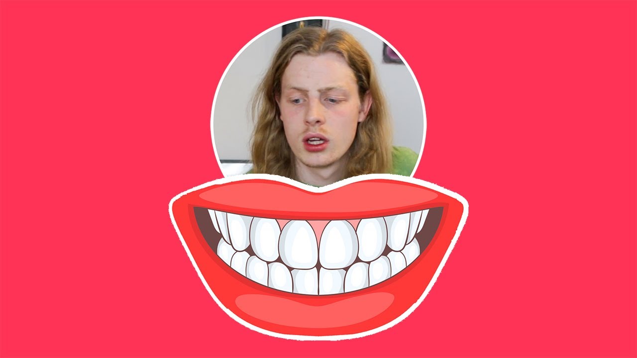 My Dentist Attempted To Rob Me of My Teeth - YouTube