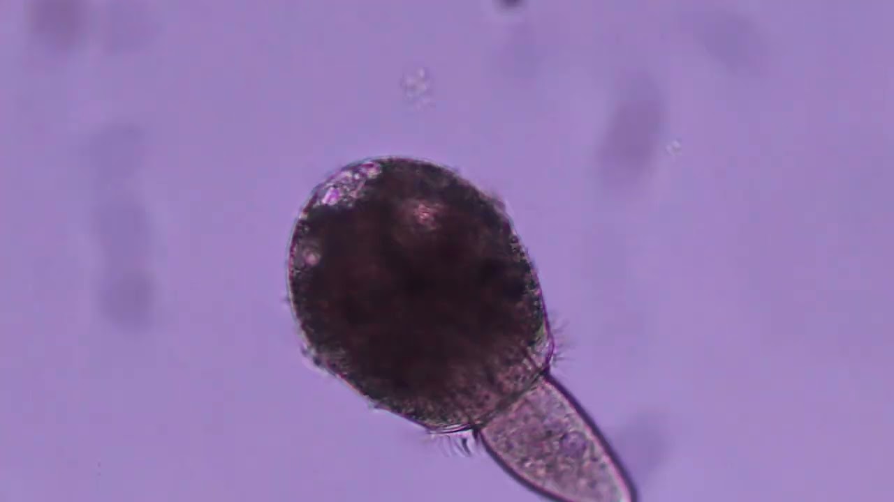 Didinium eat paramecia: Fast single-celled predators consume their prey ...