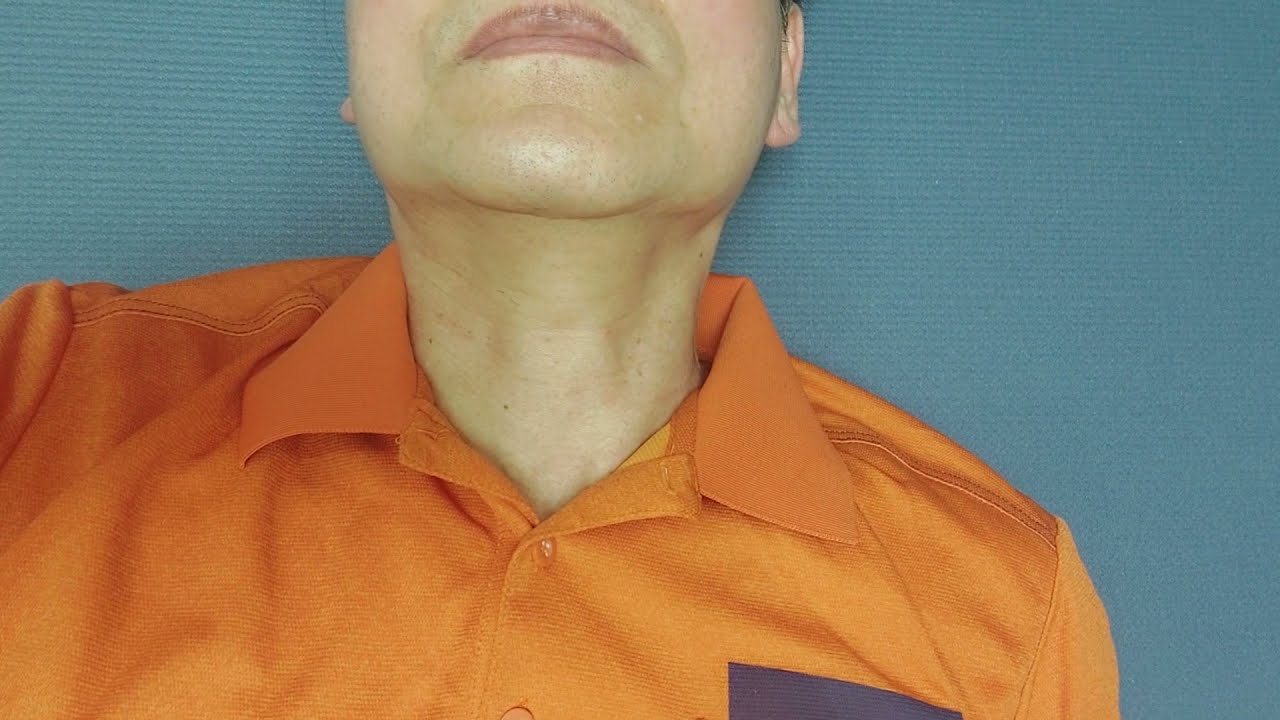 The Mendelsohn Maneuver for treating patients with pharyngeal dysphagia ...