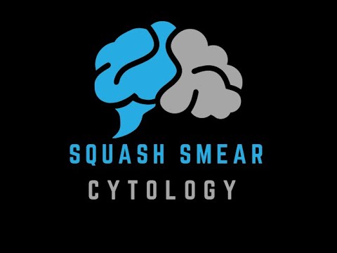 Squash smear Cytology | Complete Power point presentation and lecture ...