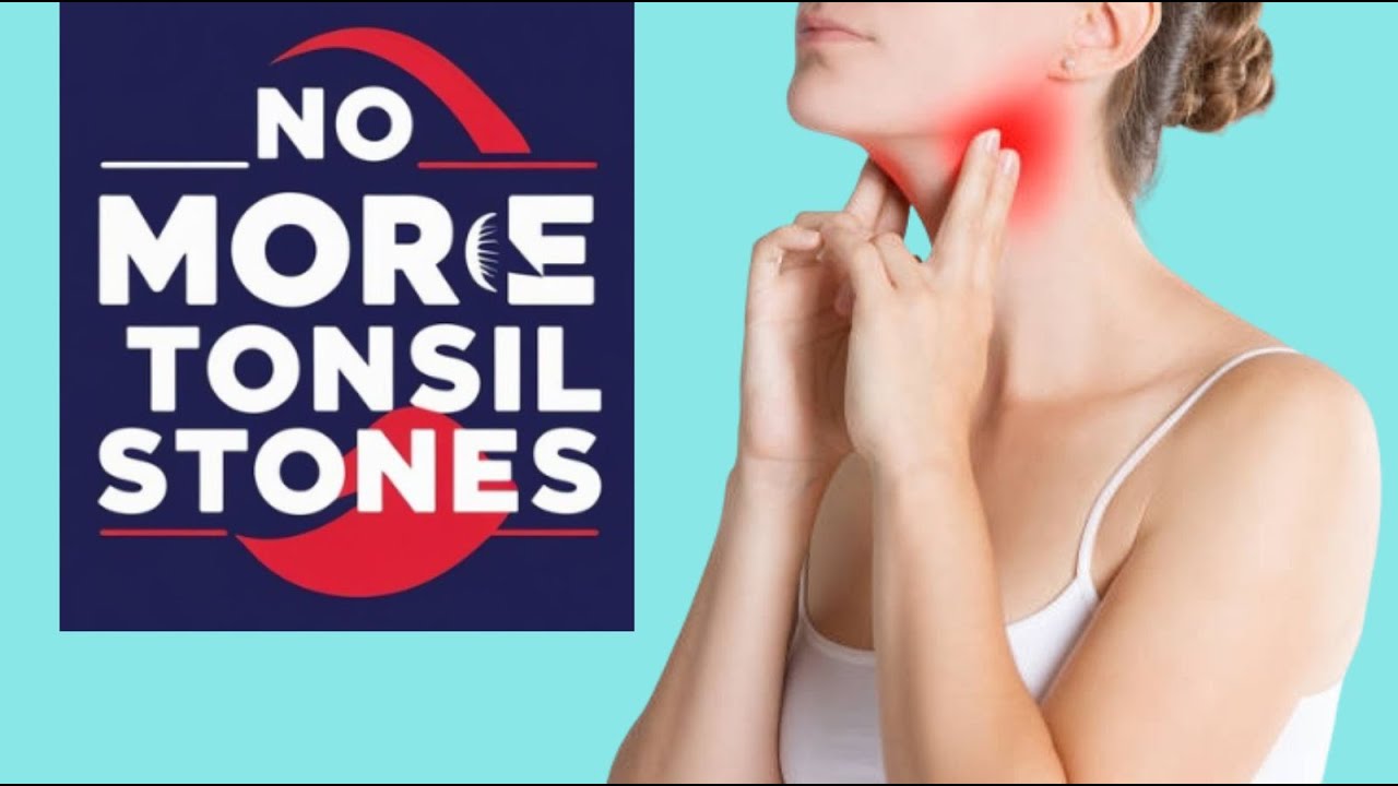 How to Remove Tonsil Stones at Home 🦷 | Easy & Safe DIY Methods - YouTube