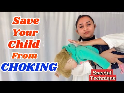 Choking techniques to save your child | dummy demonstration | special ...