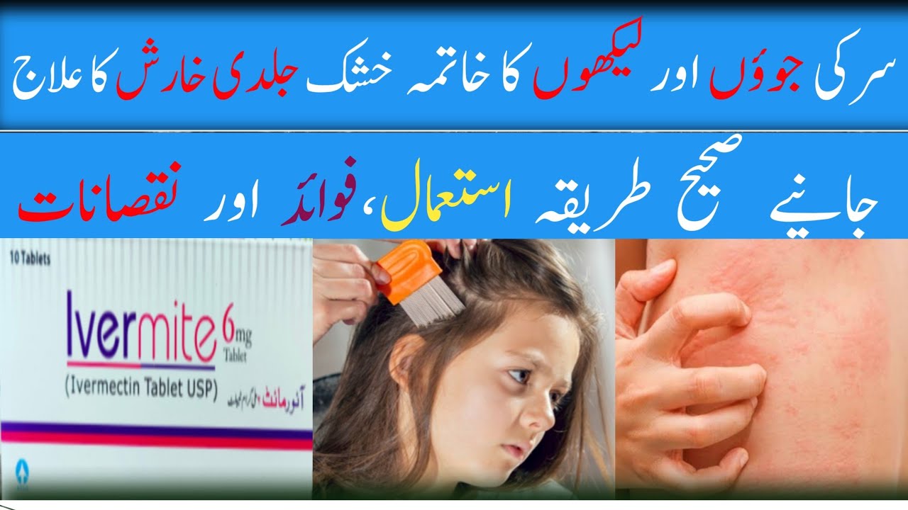 Head lices | allergy treatment | ivermite 6mg tablet use in Urdu ...
