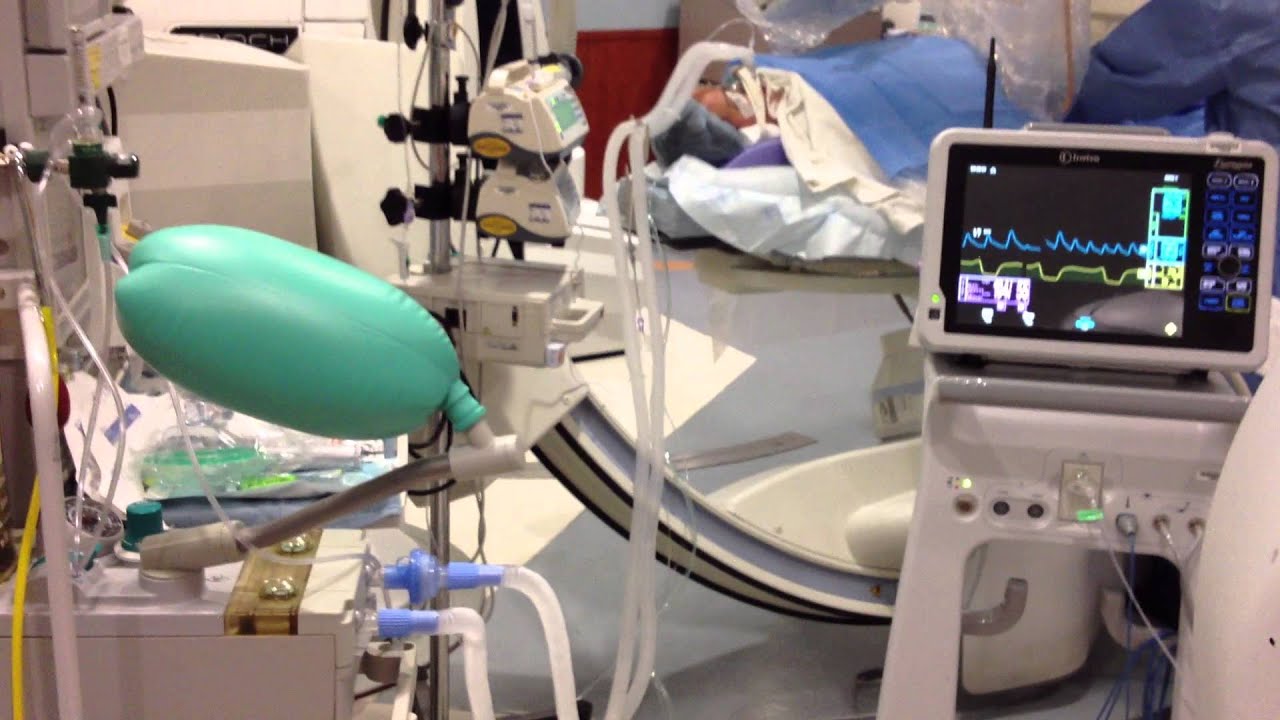 What To Expect After Svt Ablation Surgery at Jasper Corral blog