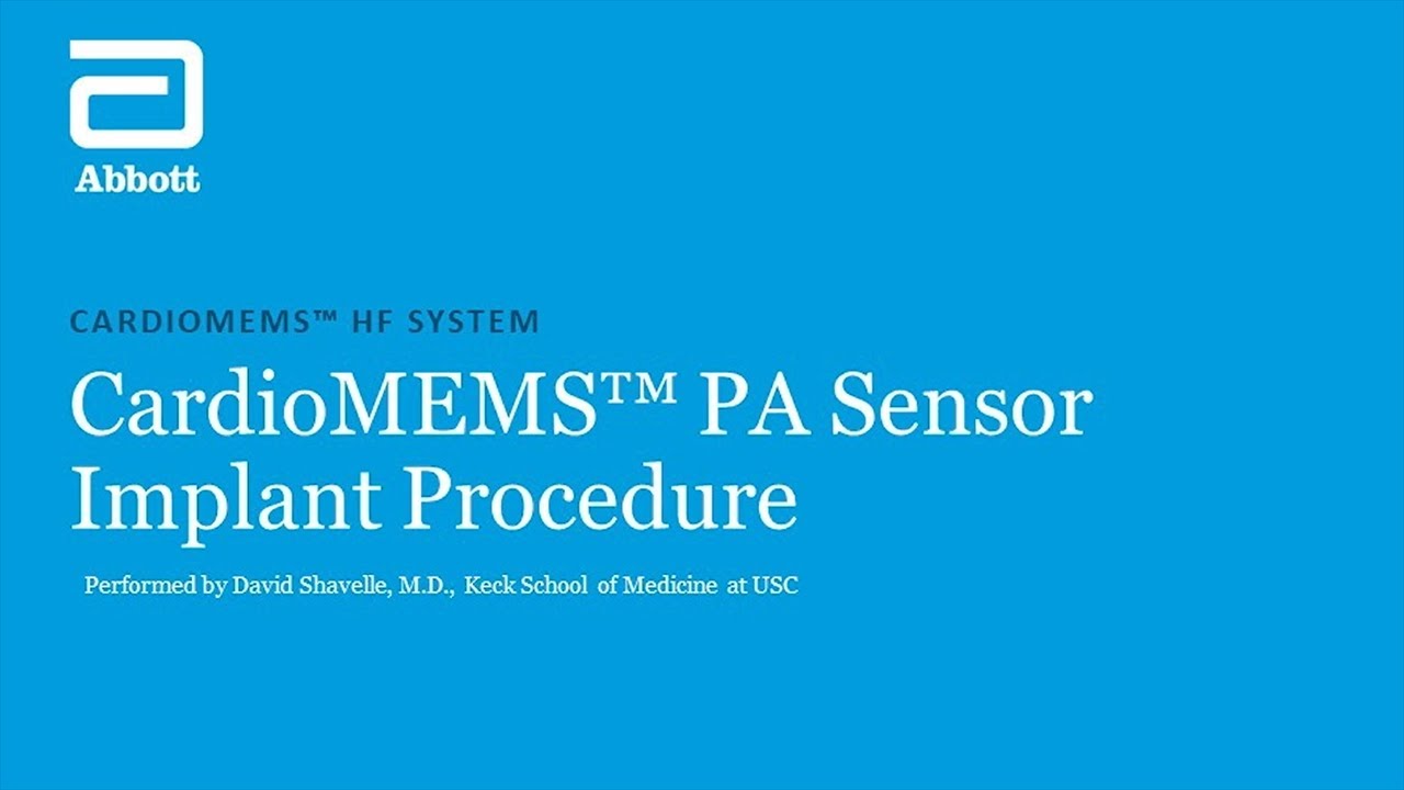 CardioMEMS PA Sensor Implant Procedure - YouTube