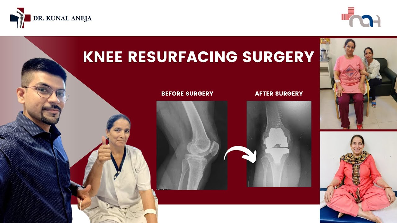 Knee Resurfacing Surgery | Fast track | no muscle cut technique | knee ...