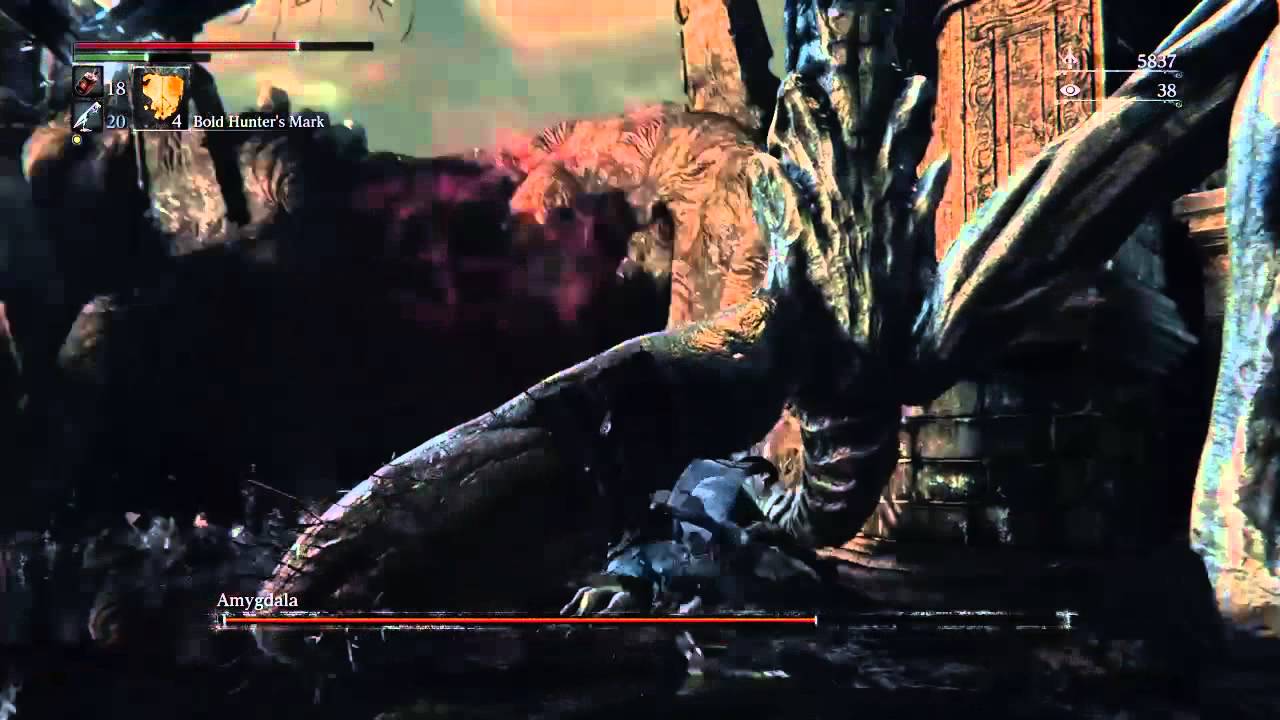 Amygdala, the Great One - YouTube