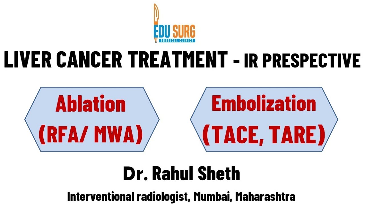 Ablation, chemoembolization and radioembolization in primary liver ...