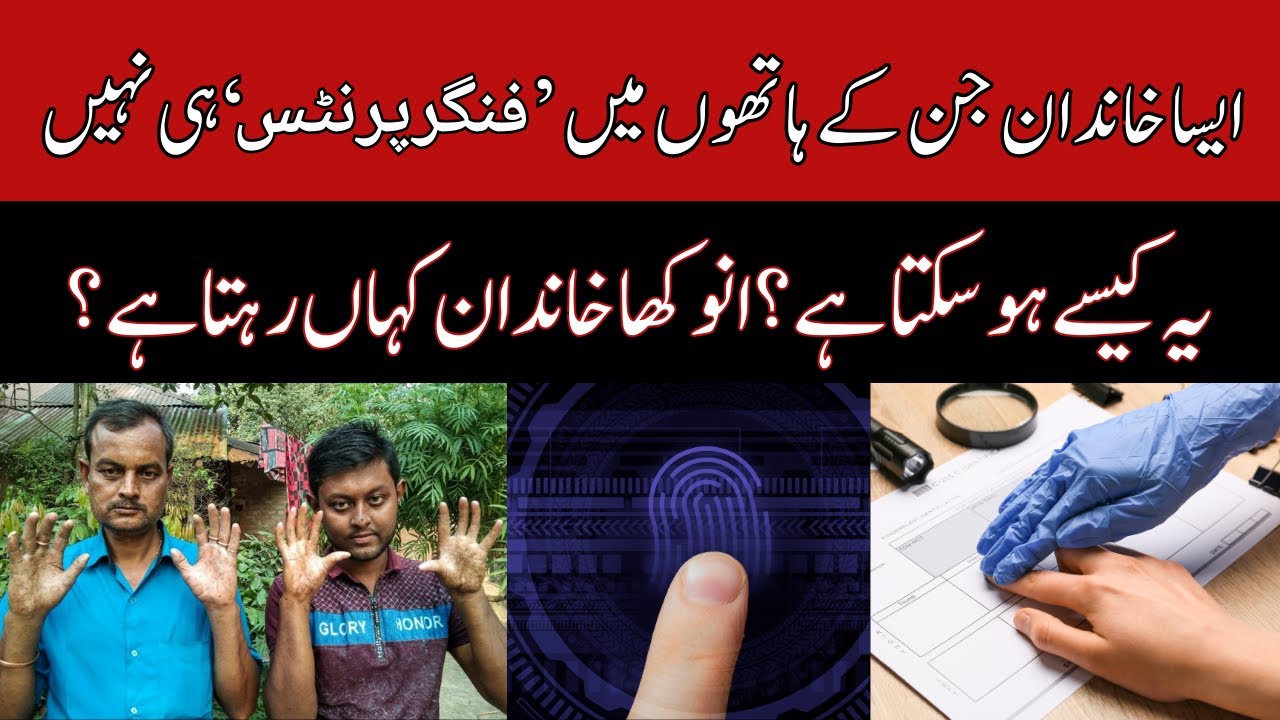 A Family Without 'Fingerprints' | How Is This Possible? - YouTube