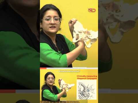 How To Calculate Obstetric Conjugate