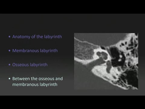 What Lies Between: Navigating the Osseous and Membranous Labyrinth