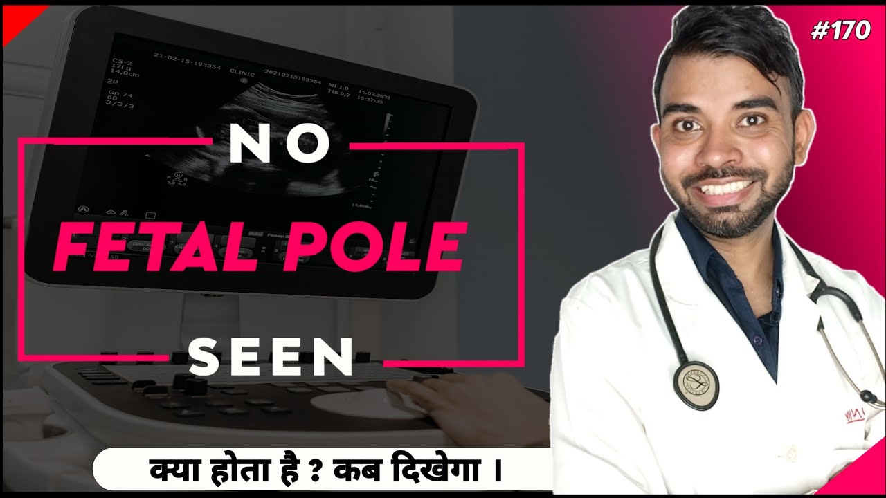 Fetal Pole