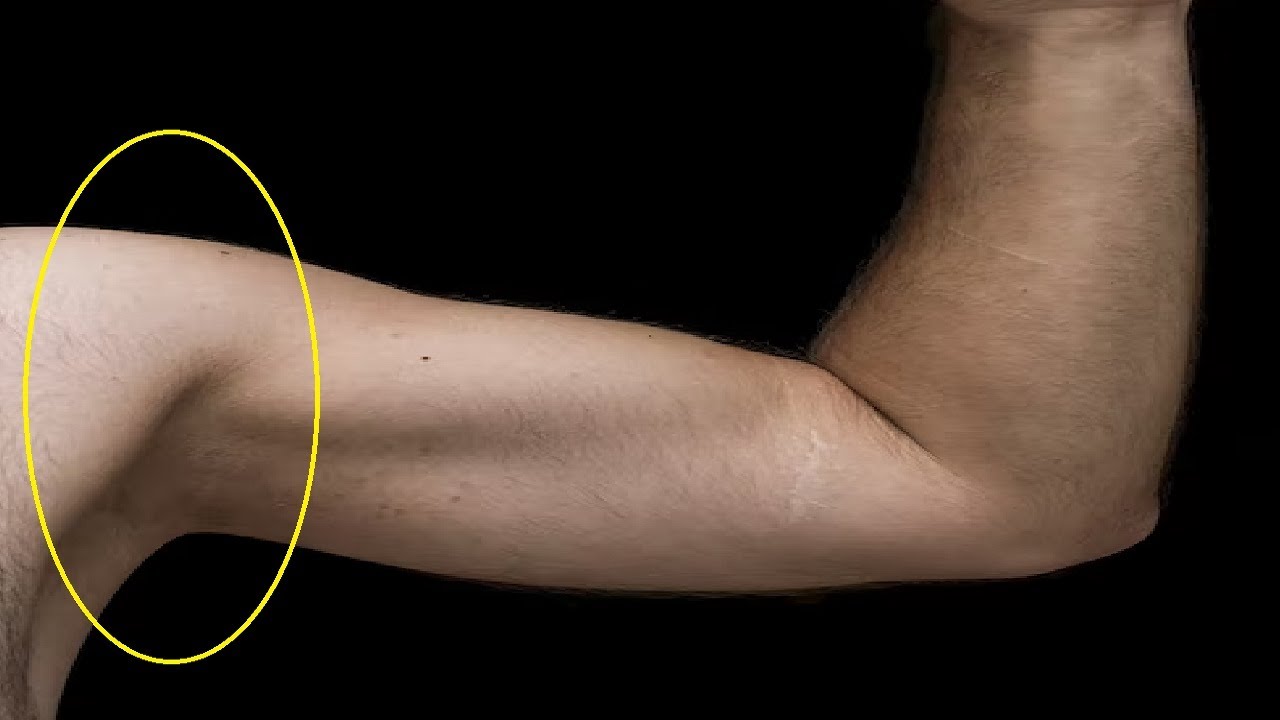 fastest workout to get rid of armpit fat - YouTube