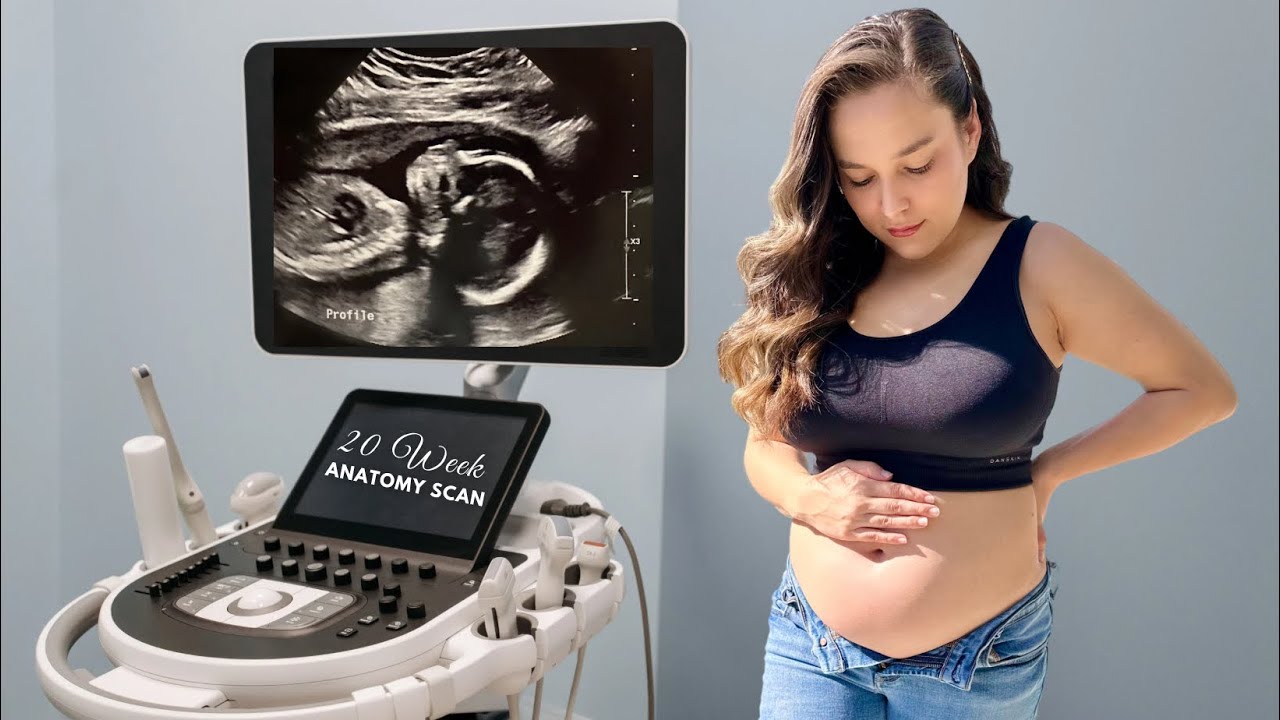 Our ANATOMY SCAN 20 Weeks Pregnant Ultrasound Halfway Done YouTube our-anatomy-scan-20-weeks-pregnant-ultrasound-halfway-done-youtube