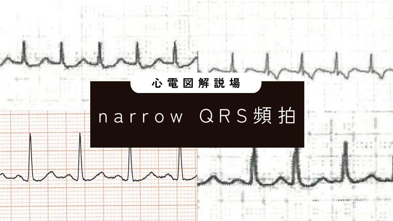 心電図解説場（narrow QRS頻拍編） - YouTube