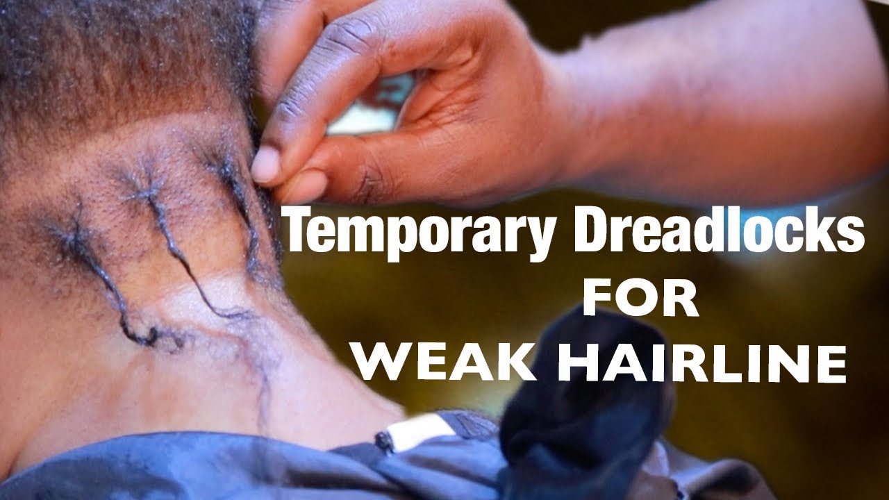 The Best Method Used To Install Temporary Dreads On (4C) Weak HairLine ...