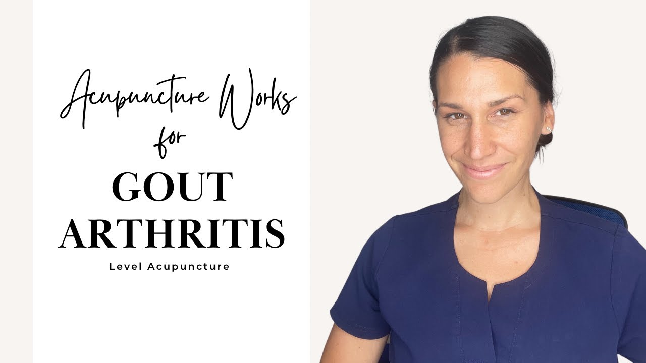 Acupuncture Works for Gout Arthritis - YouTube