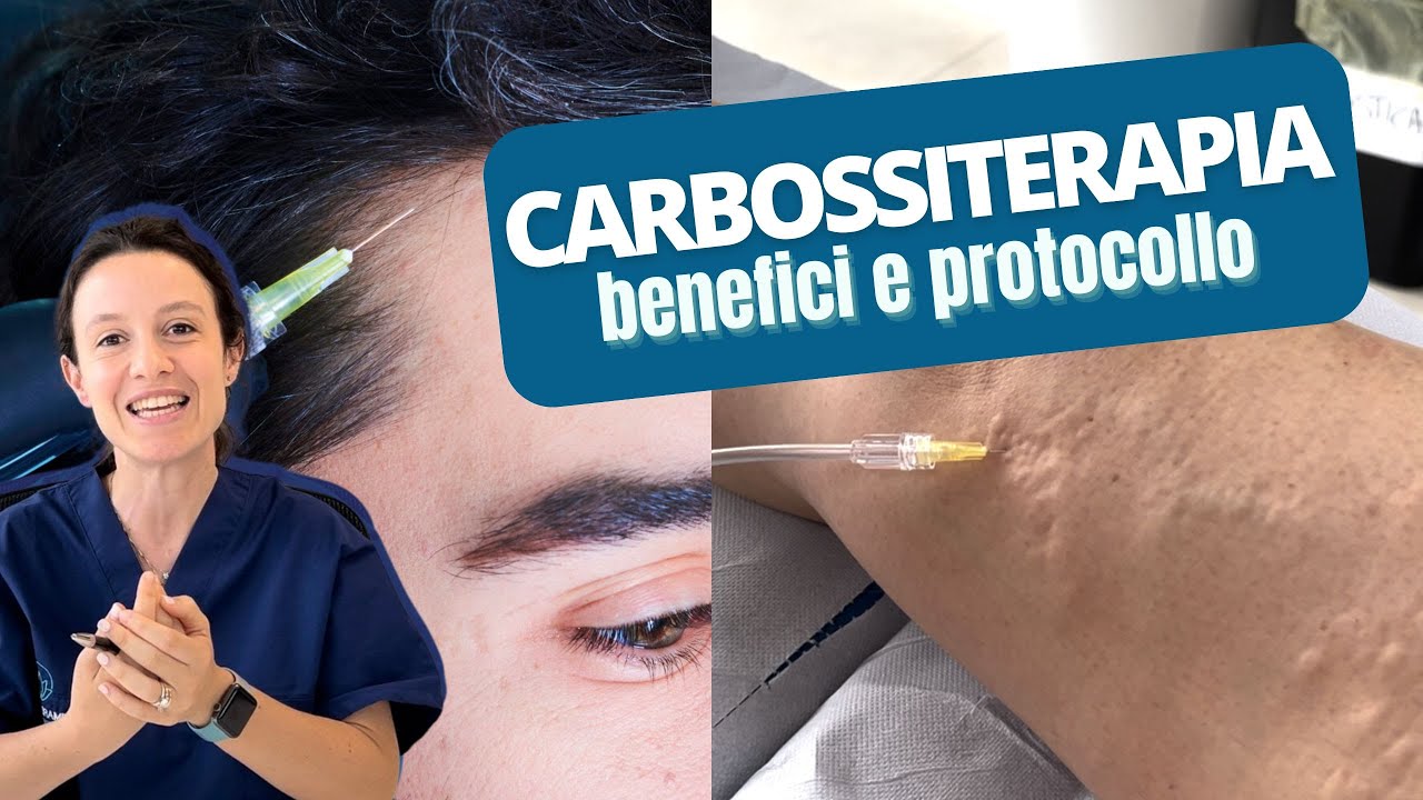Carbossiterapia: benefici e protocollo - YouTube