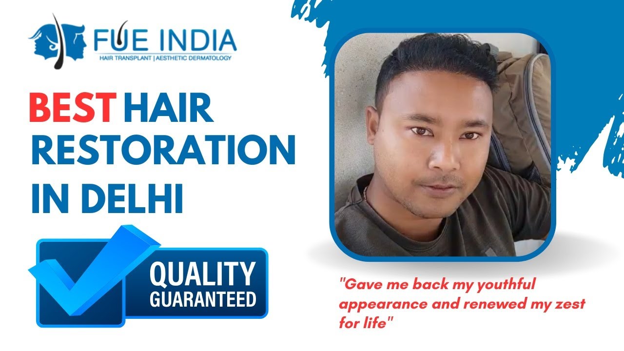 Fue India Hair Transplant | Best Hair Transplant Result | Hair Restoration In Delhi - YouTube