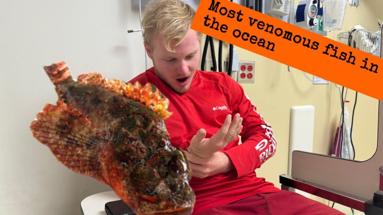 I got stung by the Most Venomous fish in the ocean while catching ...