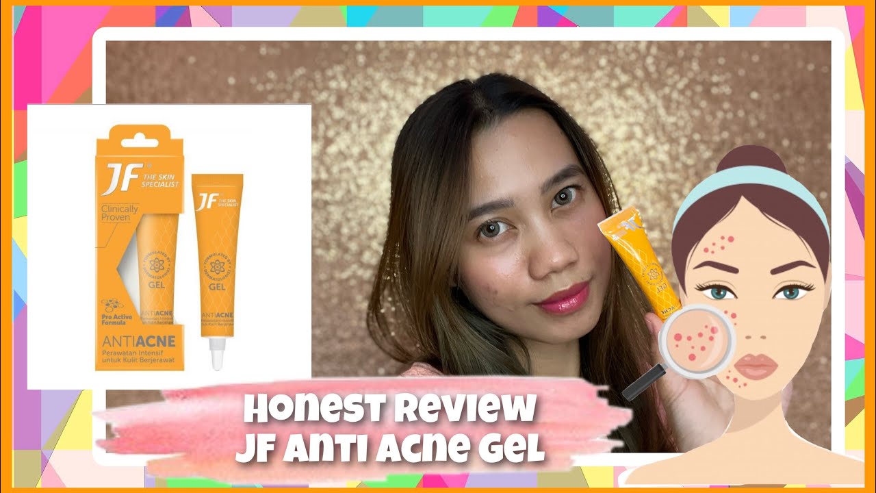 Honest Review JF Sulfur ANTI ACNE SPOT GEL - YouTube