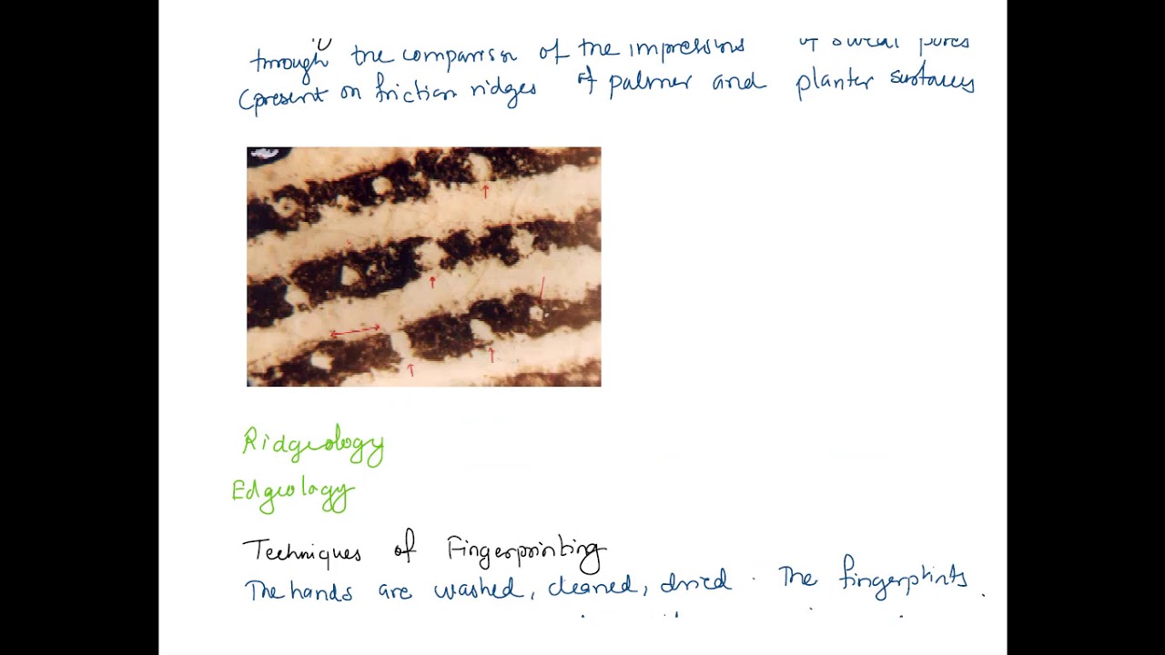 Forensic Medicine -- Identification Part 3 - YouTube