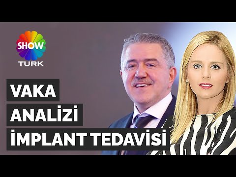 VAKA ANALİZİ: GIANNA | İMPLANT VE GÜLÜŞ TASARIMI | SHOWTURK, EYLEM AKSIN & M.SC.DT ZAFER KAZAK