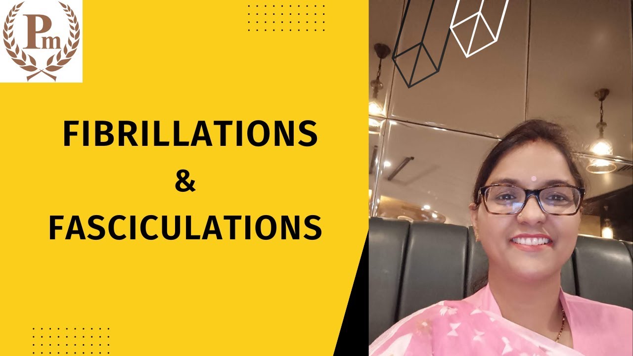 A Quick revision of the difference between Fibrillations and ...