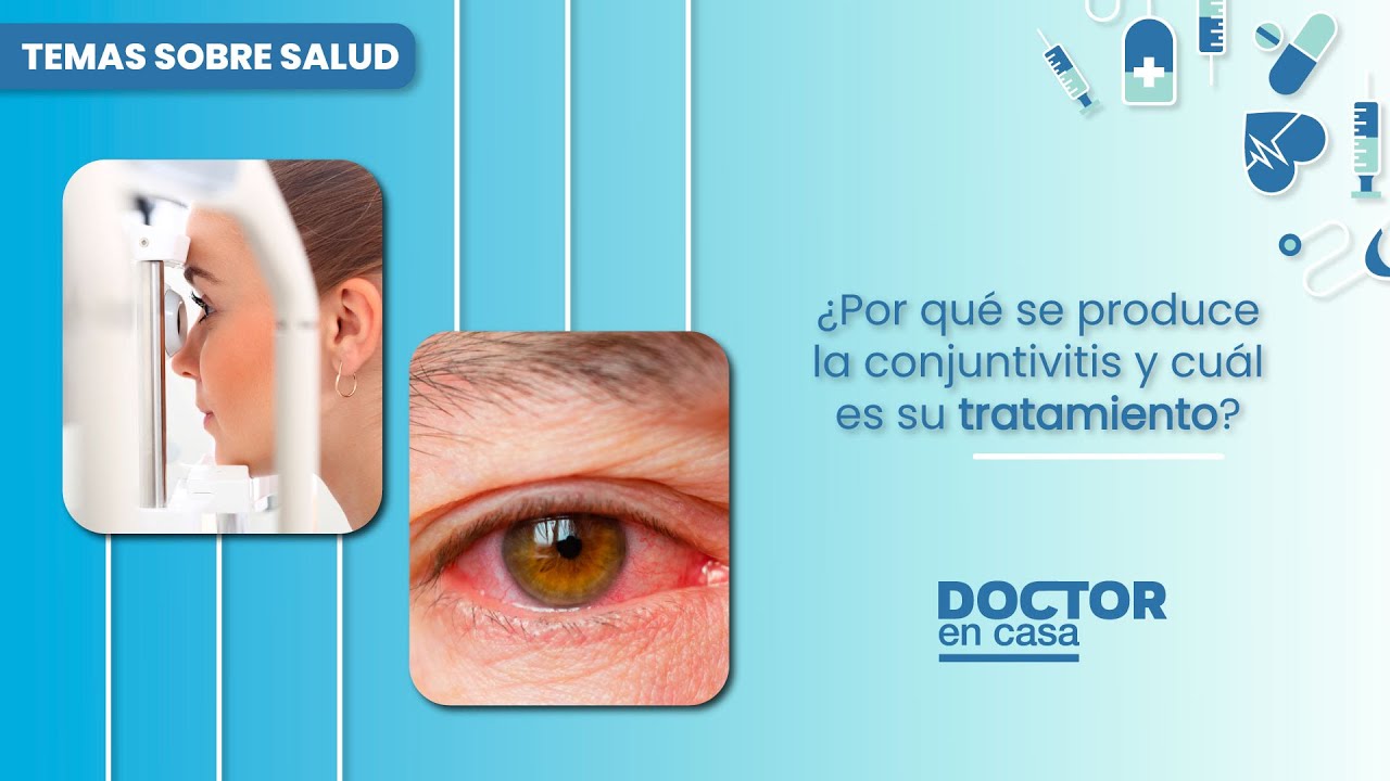 ¿Por qué se produce la conjuntivitis y cuál es su tratamiento? - YouTube